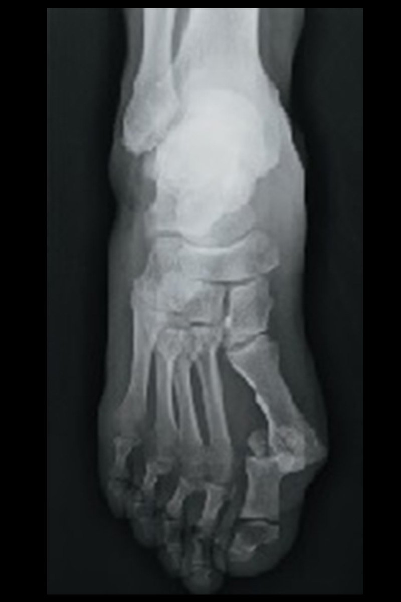 General X-Ray North West, Mafikeng: North West General X-Ray